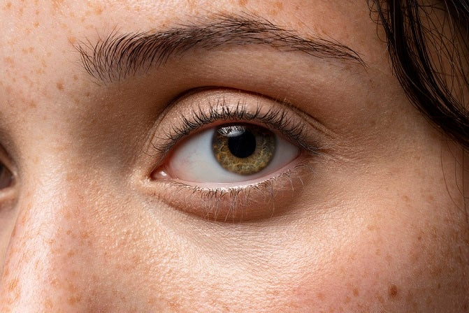 Under-Eye Puffiness and Dark Circles - Get Rid of Them | Tuffy Organics